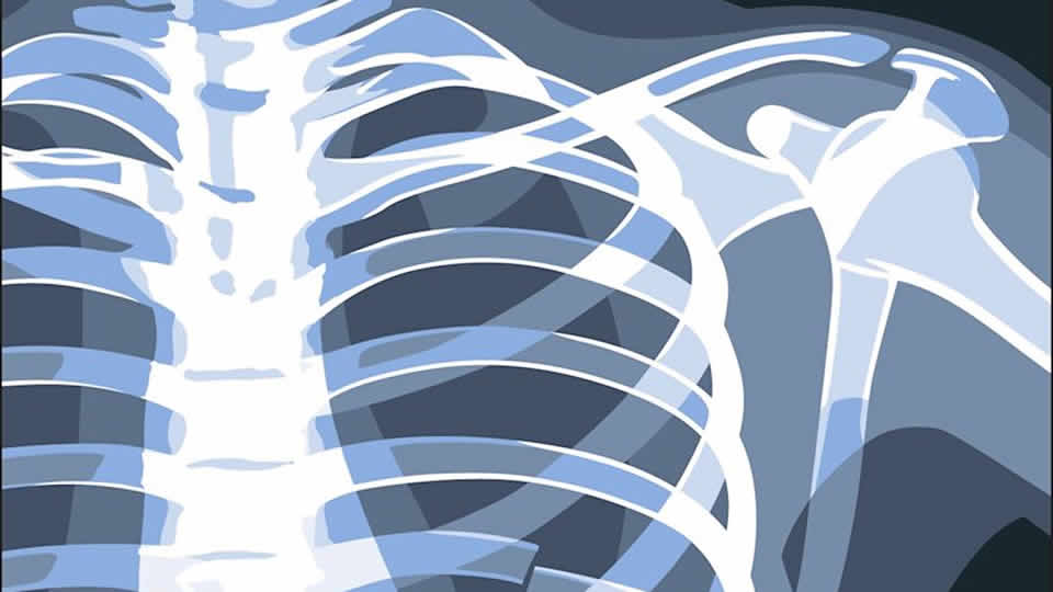 X-ray by Nicole Lobdell – medhum.org